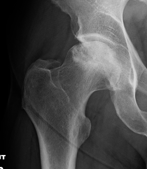 Background | The Bone School